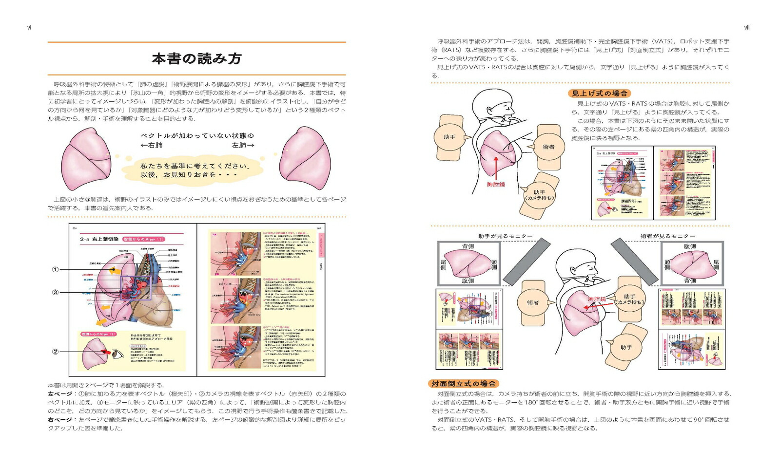 楽天ブックス ベクトル視点でやさしく読み解く呼吸器外科手術解剖イラスト 安部美幸 9784524204151 本